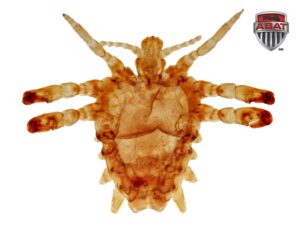 Pubic,Louse,(pthirus,Pubis),Under,Microscope