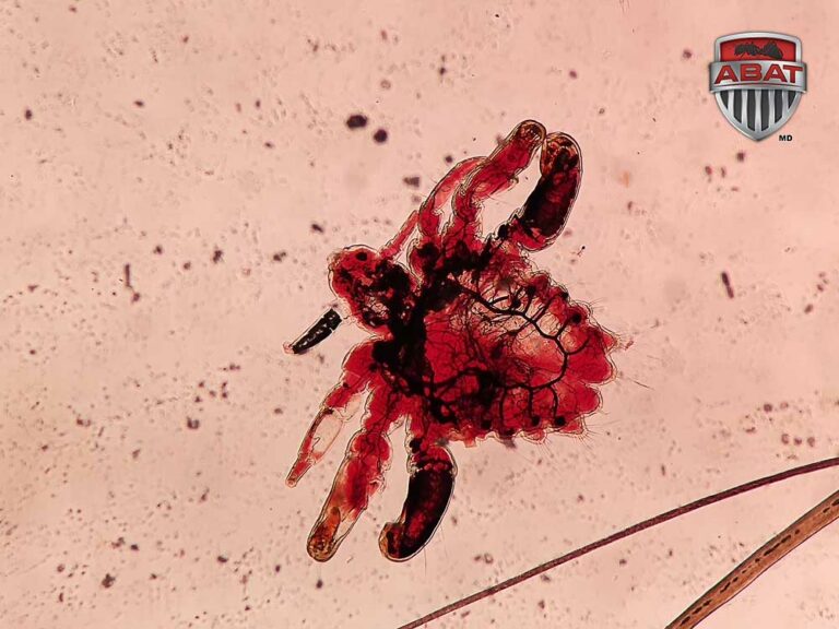 Le morpion : identifier, comprendre et traiter les poux du pubis